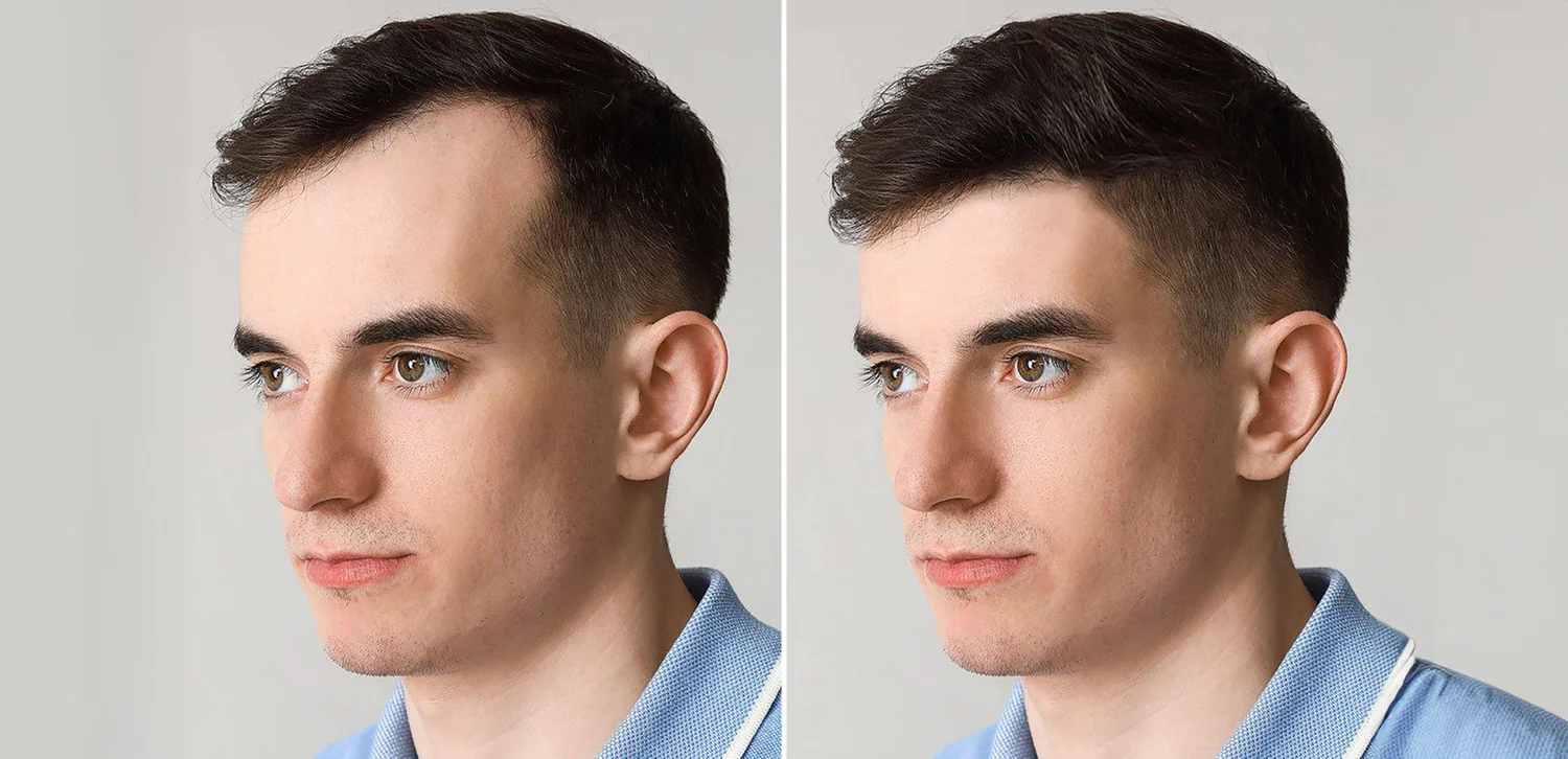 6 Daily Habits That Worsen Hair Loss and Ways to Fix It - London Post
